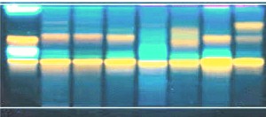 Thin Layer Chromatography - Forensic's blog