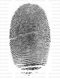 Types Of Fingerprint Patterns Forensic S Blog