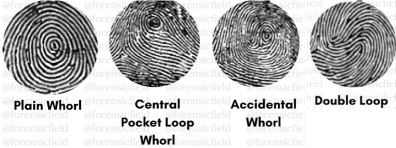 Types Of Fingerprint Patterns Forensic S Blog